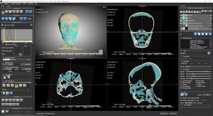 King Tut's Face Reconstructed By Bioarchaeologist - Ancient Pages