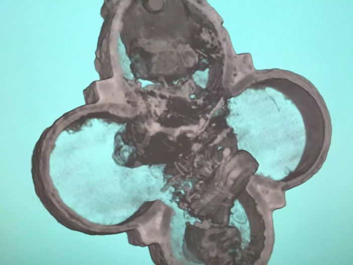 Bone Fragments Found Inside Mysterious Medieval Pendant - Ancient Pages