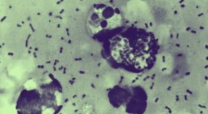 Large-Scale DNA Study Traces 37,000 Years of Disease History - Ancient ...
